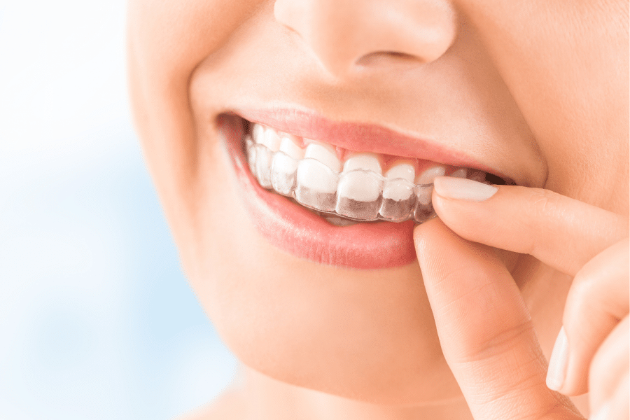 Invisalign Benefits - Dentist Cary - Invisalign Raleigh, NC | Cary ...